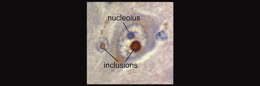 Mutations on the Brain!!! | Science Over a Cuppa